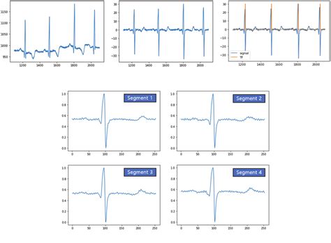 preprocessing pipeline results of continuous ecg data download
