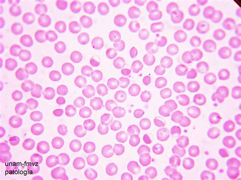 Departamento De Patología Fmvz Imagen Del DÍa Excentrocitos Eritrocitos Que Tienen La