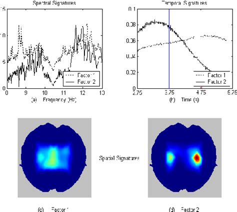 Figure 2 From Parallel Space Time Frequency Decomposition Of Eeg Signals For Brain Computer