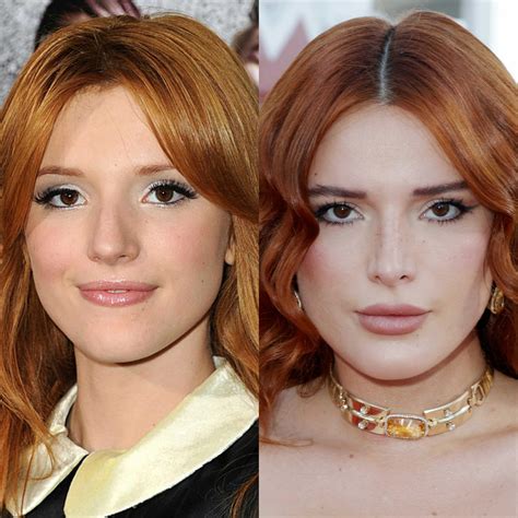 9 Celebrities Before And After Dramatic Lip Fillers Evie Magazine