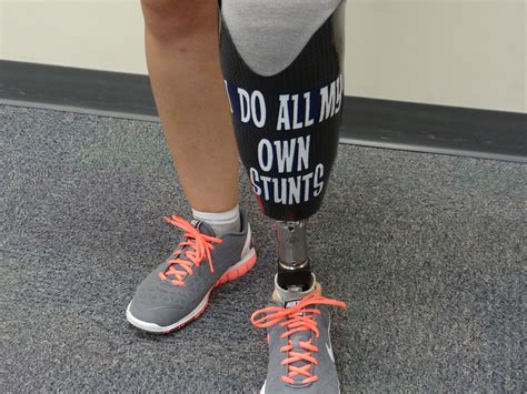 Prosthetic And Orthotic Associates