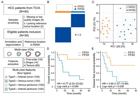 Hcc Patients Stratified Into Two Subtypes By Multi View Radiomics Download Scientific Diagram