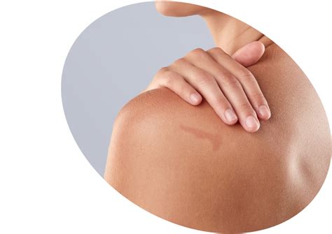 Dark Spots And Body Hyperpigmentation Shop Brightening Products Usa