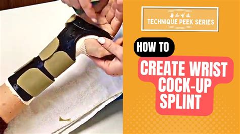 How To Create A Wrist Cock Up Splint Technique Peek Series Youtube