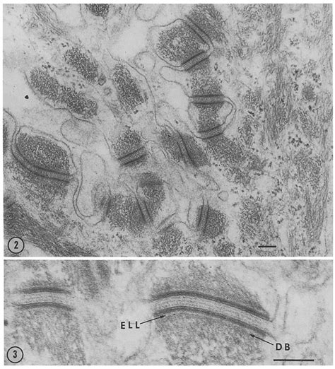 Portions Of Spinons Cells Of Cow Nose Epidermis Showing Typical Download Scientific Diagram