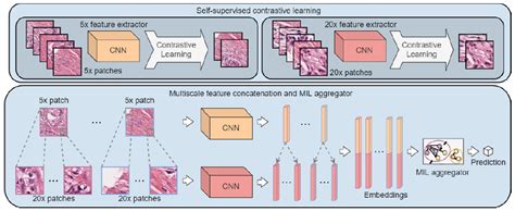 Dual Stream Multiple Instance Learning Network For Whole Slide Image Classification With Self