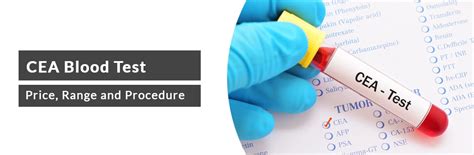 CEA Blood Test Price Range And Procedure Ganesh Diagnostic
