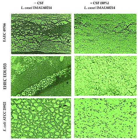 Structural Examination Of The Effect Of The CSF From L Casei IMAU60214 Download Scientific