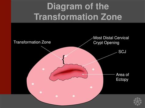 Ppt Health Systems Approach To Referral And Treatment Powerpoint