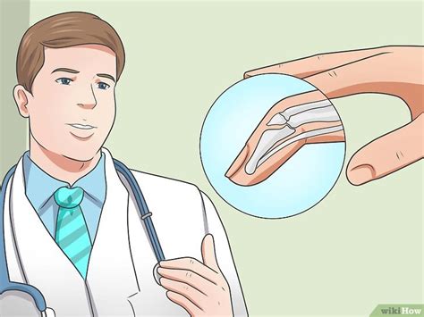 How To Splint A Broken Extensor Tendon
