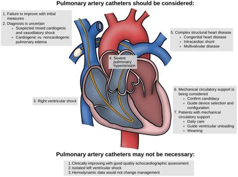 Cardiogenic Shock