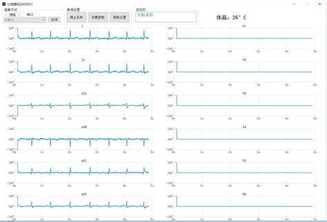基于ads1298的心电图仪 Csdn博客
