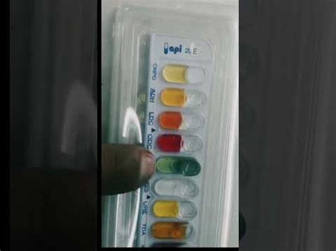 Performing API 20E Srip Test Introduction To API Test Analytical Profile Index MLTBIOCONNECT