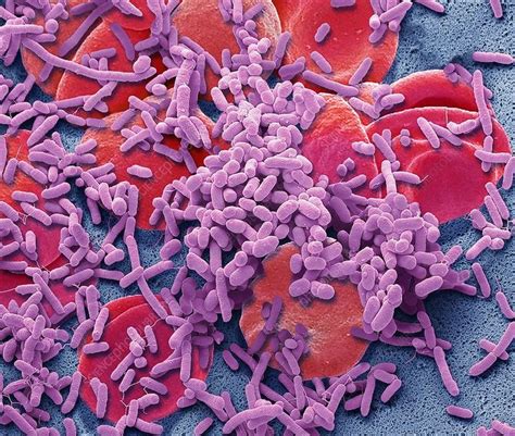 Sepsis SEM Stock Image C034 5870 Science Photo Library Sepsis
