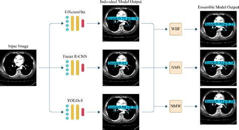 Figure 1 From Deep Learning In Computed Tomography Pulmonary