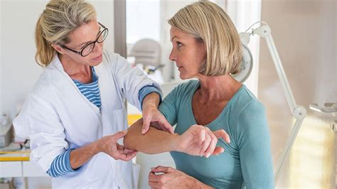 Fast Five Quiz The Jak Stat Pathway And Atopic Dermatitis Frank Herd