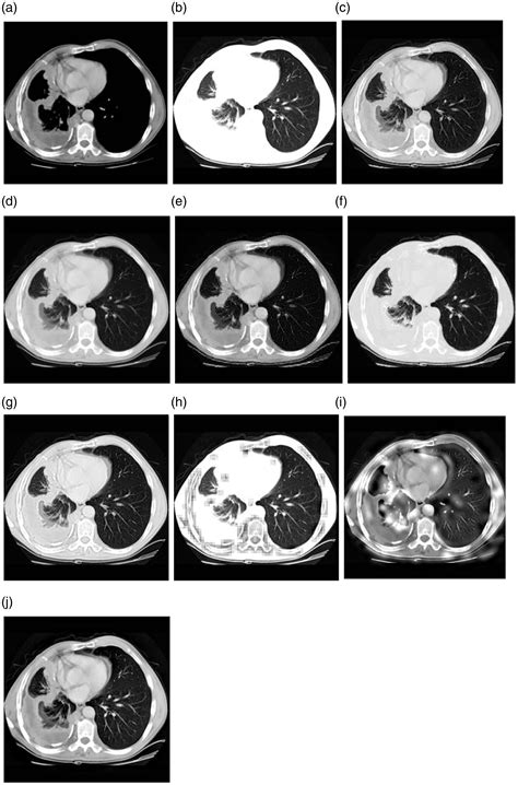 Image Fusion Based On Shift Invariant Shearlet Transform And Stacked Sparse Autoencoder Peng