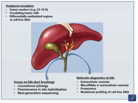 Cholangiocarcinoma Type
