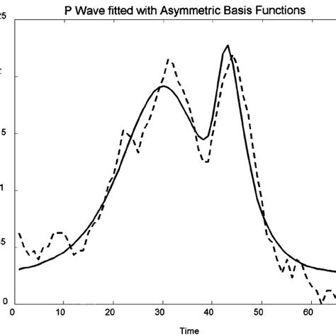 A Neural Network For P Wave Feature Extraction Using Two Asymmetric