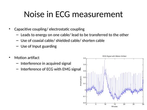 Module 2part 1 Ecg Powerpoint Prespptx