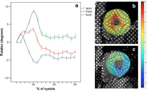 Average Apical Rotation Red Basal Blue Rotation And Twist Green