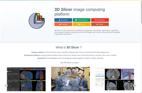 Horos Open Source Medical Image Viewer Sugggest