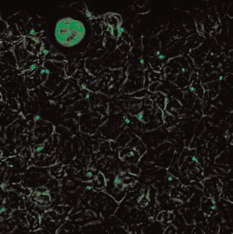 Forensic Detection Of Sperm From Sexual Assault Evidence Science Lab Leica Microsystems