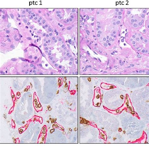 Peritubular Capillary Inflammatory Cells Margination Peritubular Download Scientific Diagram
