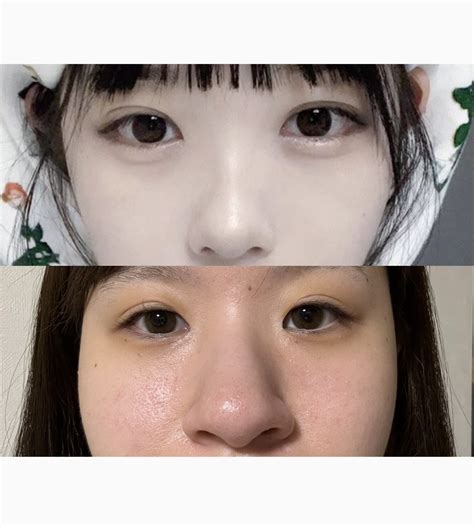 의사에게 물어보세요 못생겨서 눈을 더럽 강남언니 1등 성형수술and피부시술 정보앱