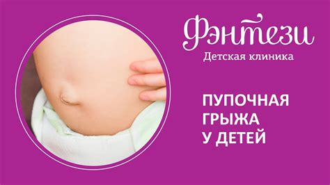 👩‍⚕️ Пупочная грыжа у детей - YouTube