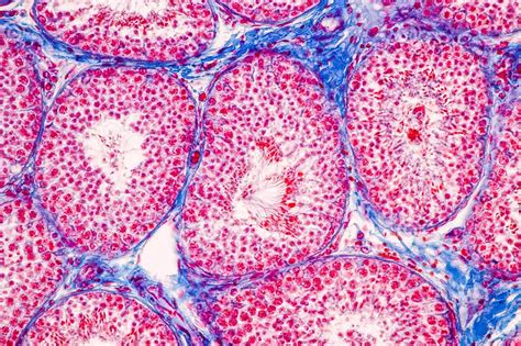 Histological Epididymis And Testis Human Cells Under Microscope Stock