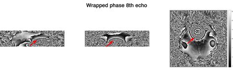 Choosing A Right Phase Unwrapping Method For Your Data SEPIA Documentation