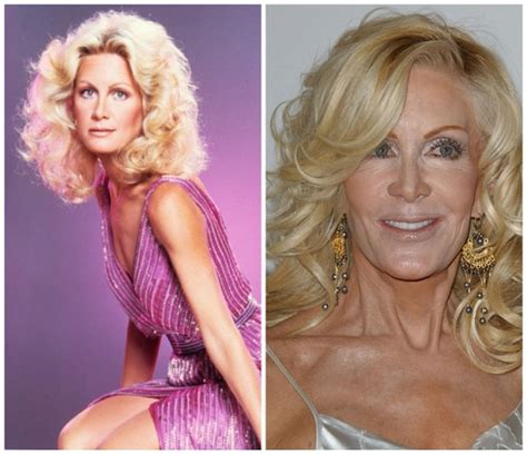 Joan Van Ark Before And After Plastic Surgery Boob Nose Face