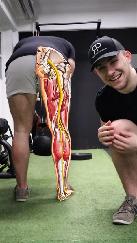 💥 What Is Sciatica 😨 Sciatica Is A Type Of Pain That Stems From The