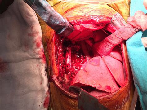 Division Of The Nerve Roots By Ligation Download Scientific Diagram