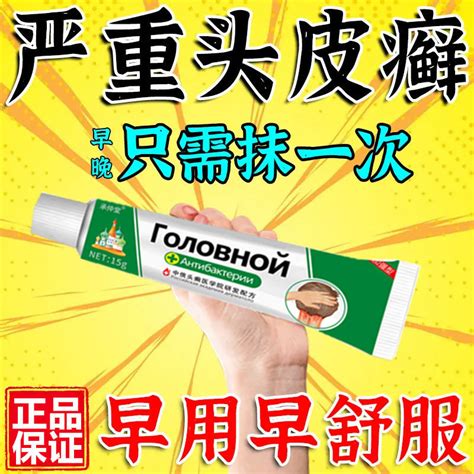 Scalp Ringworm Ointment Scalp Itching Yellow Ringworm White Scalp
