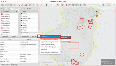 Qupath Tissue Segmentation Using A Pixel Classifier Cancer Informatics
