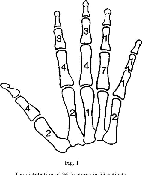 Figure 1 From External Fixation For Phalangeal And Metacarpal Fractures