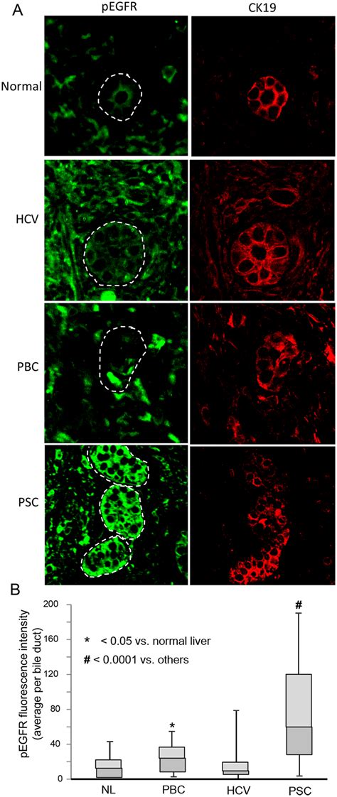 Cholangiocytes In Psc Diseased Livers Exhibit Increased Phospho Egfr Download Scientific