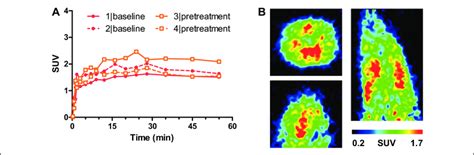 A Whole Brain Time Activity Curves Of 11 C Bexarotene In Rat At