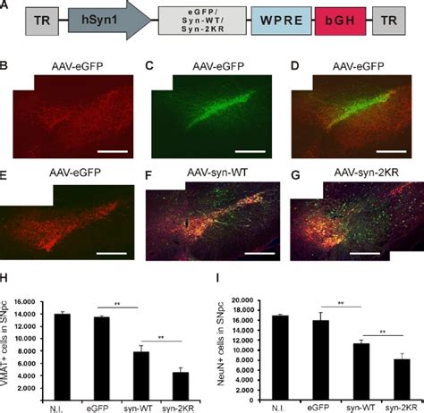 Sumoylation Inhibits α Synuclein Aggregation And Toxicity Pmc