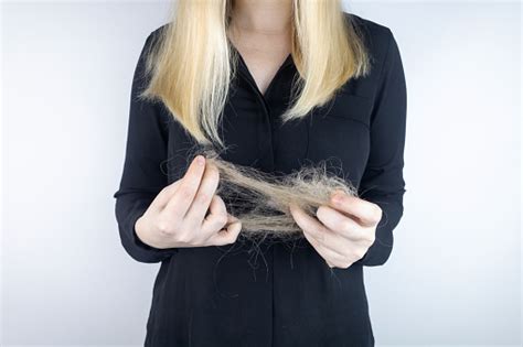 머리카락이 떨어지는 소녀의 클로즈업 빗에는 엉킨 곱슬 머리가 커서 있습니다 금발은 프레임에 화가 보인다 두피에 여성의 개념 문제 개념에 대한 스톡 사진 및 기타 이미지