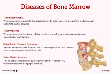 Bone Marrow Human Anatomy Image Function Diseases And Treatments