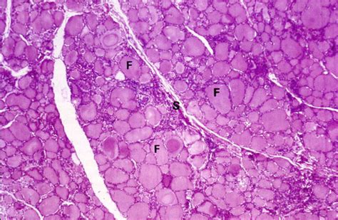 Thyroid Lab Flashcards Quizlet