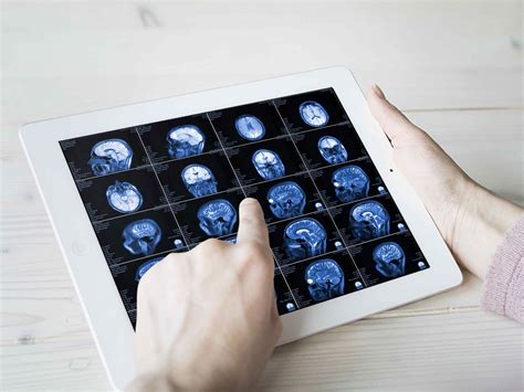 Mastering Neurosurgery Coding Accurate Billing And Compliance