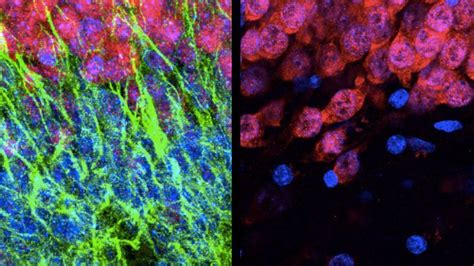 brain tissue samples from people of all ages suggest we stop growing