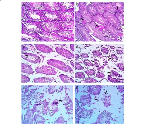 Photomicrograph Of H And E 10x Stained Sections Of Formalin Fixed