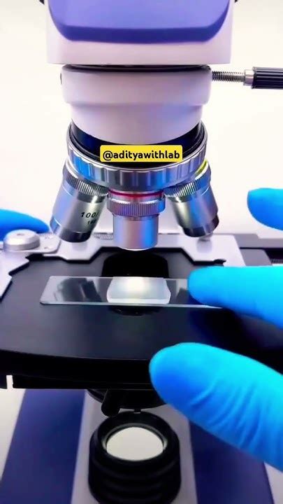 Sperm Identify Under The Microscope 🔬 Adityawithlab Labtechnologist