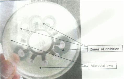 Inhibition Zones And Microbial Lawn Figure 2 Mic Determination