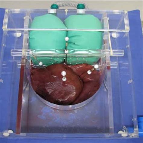 Respiratory Liver Motion Simulator In Full Inspiration With Mounted